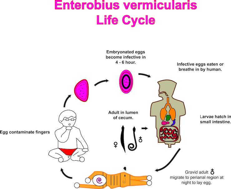 Ossiuri, i "vermi dei bambini": cosa sono e come mandarli via