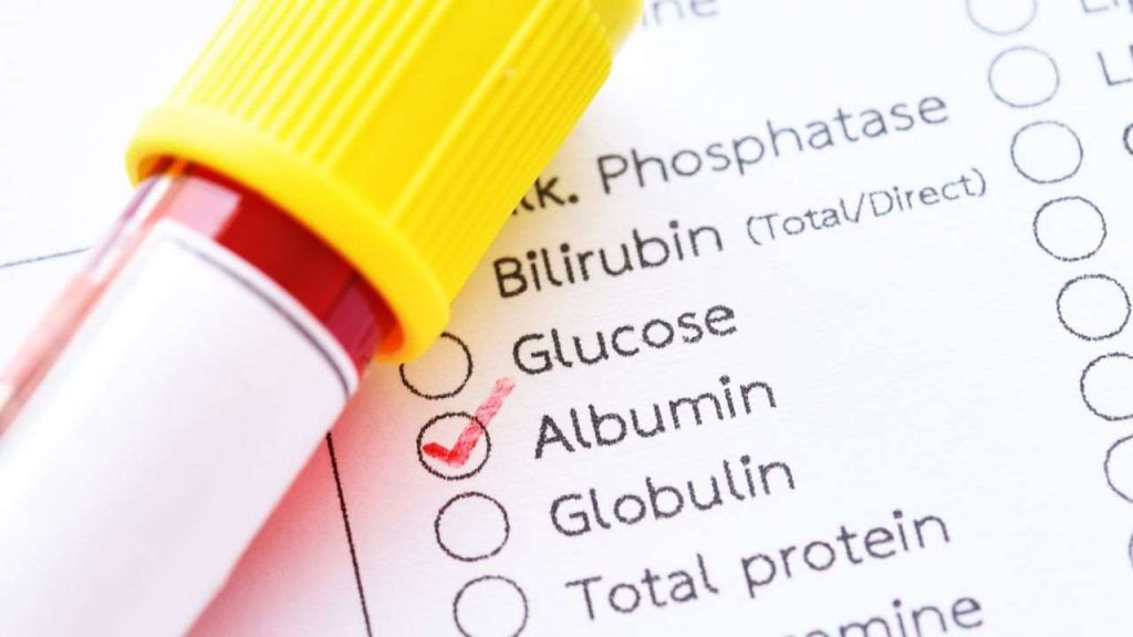 Albumina alta nelle analisi del sangue e delle urine, meglio contattare ...